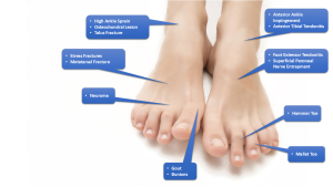 Foot Pain: Range of Symptoms, Their Causes, and Evidence-Based Feet ...